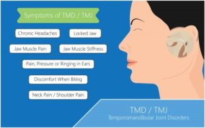 Ultrasound Therapy for TMJ: How Does It Work and Is It Effective in 2023? - Top Nova Orthodontics